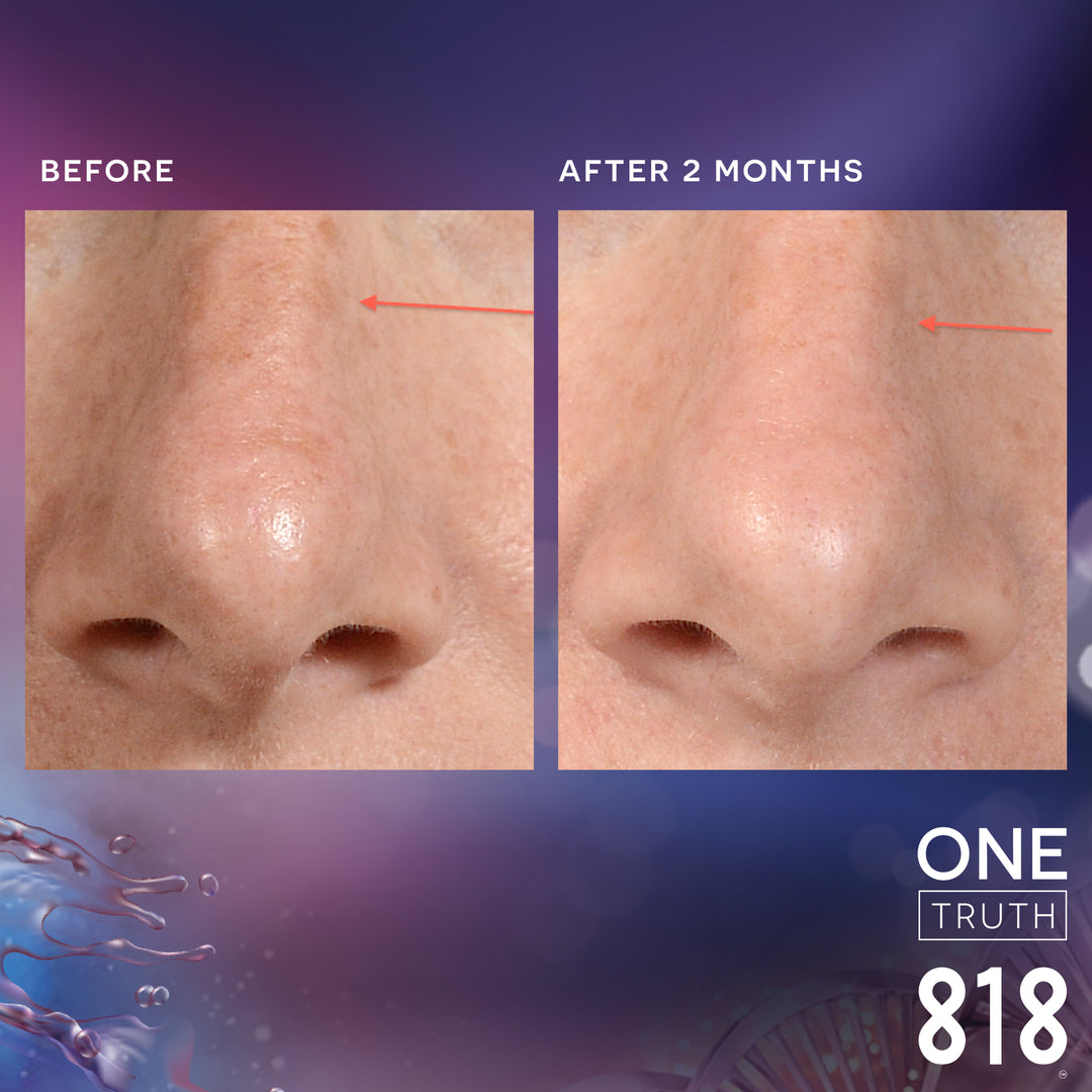 Before and Afters – One Truth 818