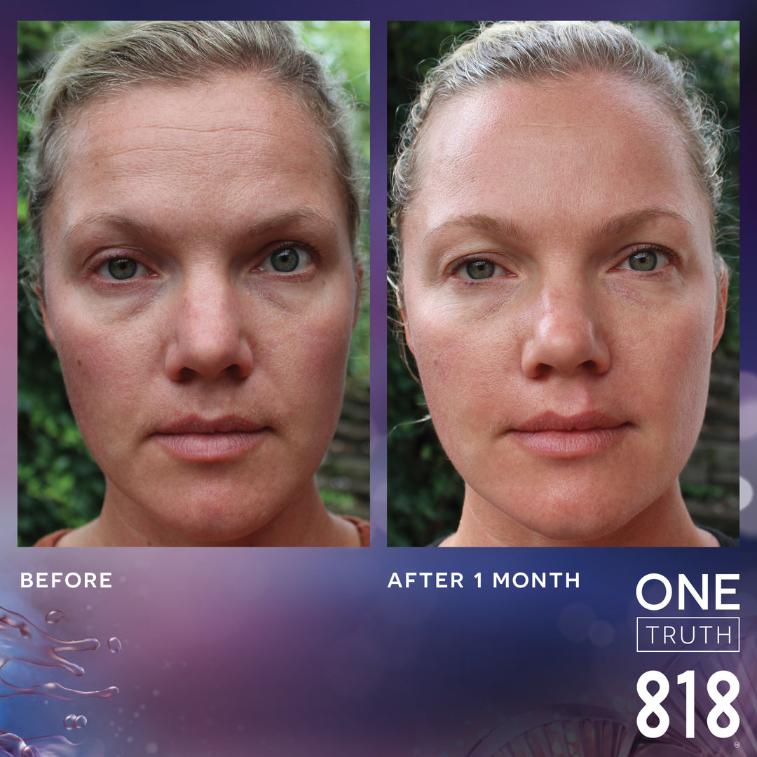 Before and Afters – One Truth 818