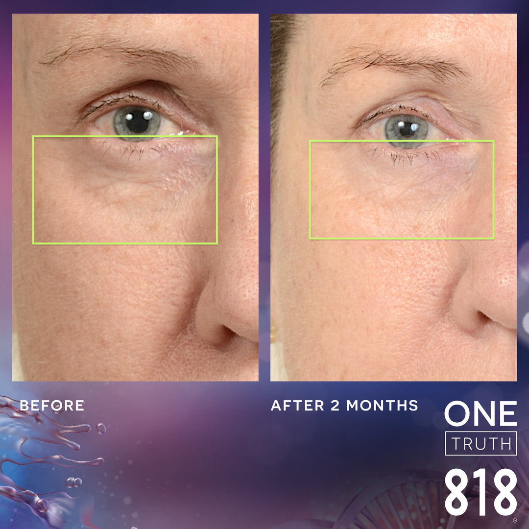 Before and Afters – One Truth 818