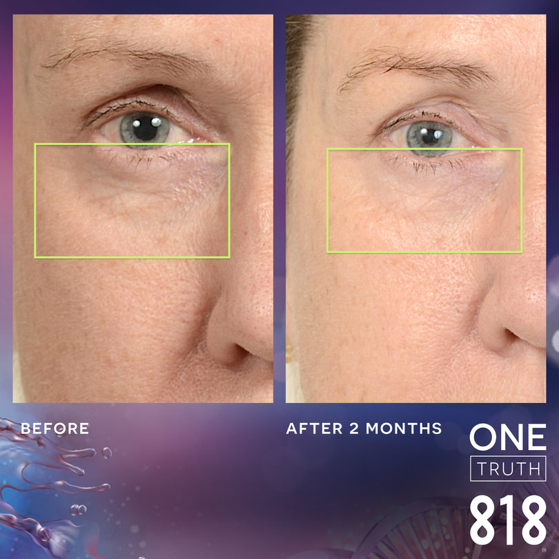 Before and Afters – One Truth 818