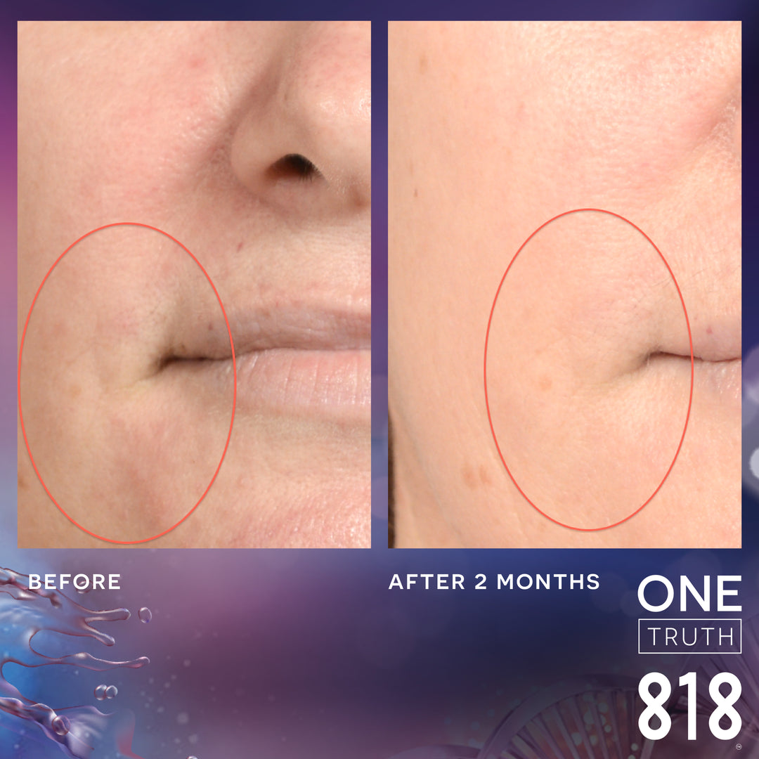 Before and Afters – One Truth 818