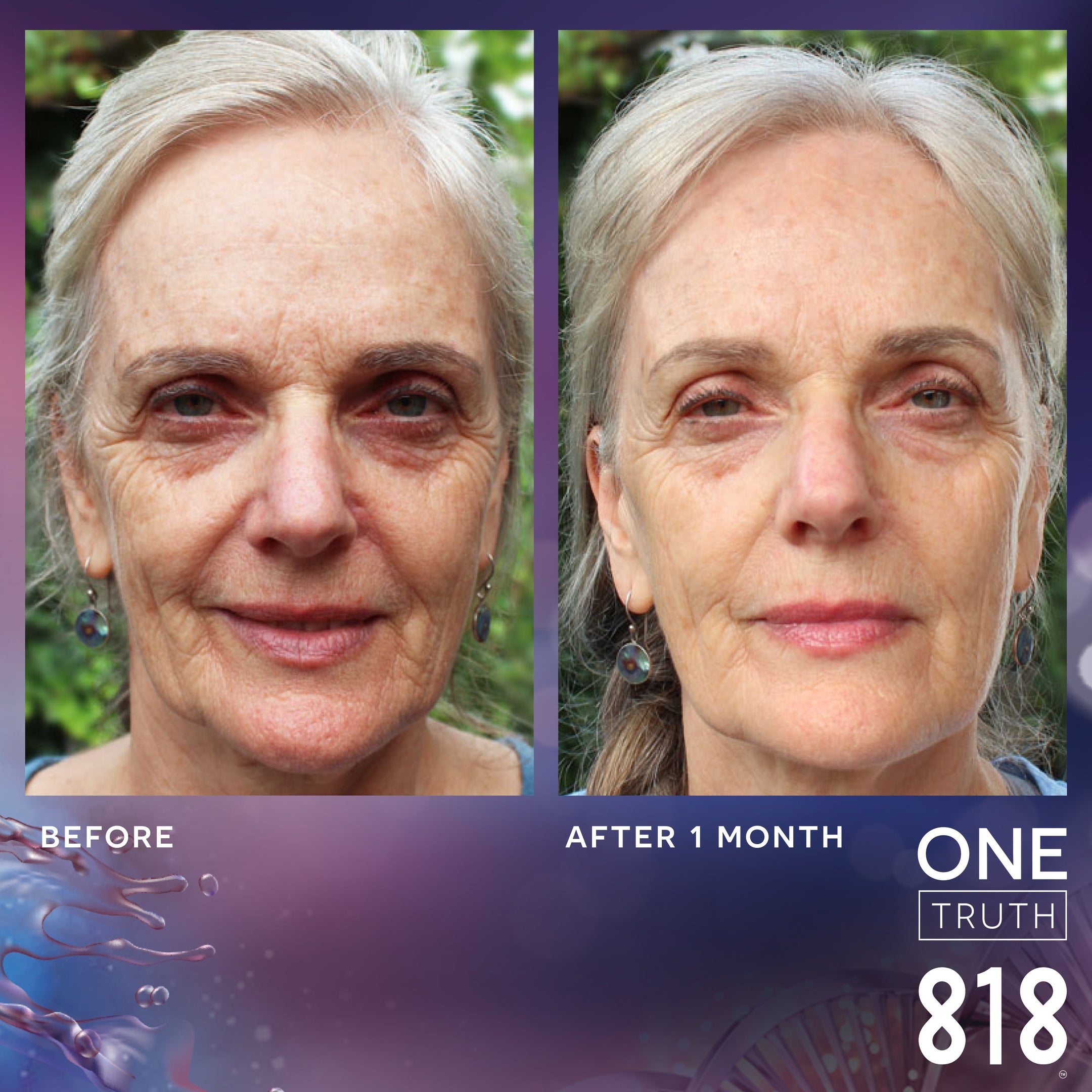 Before and Afters – One Truth 818